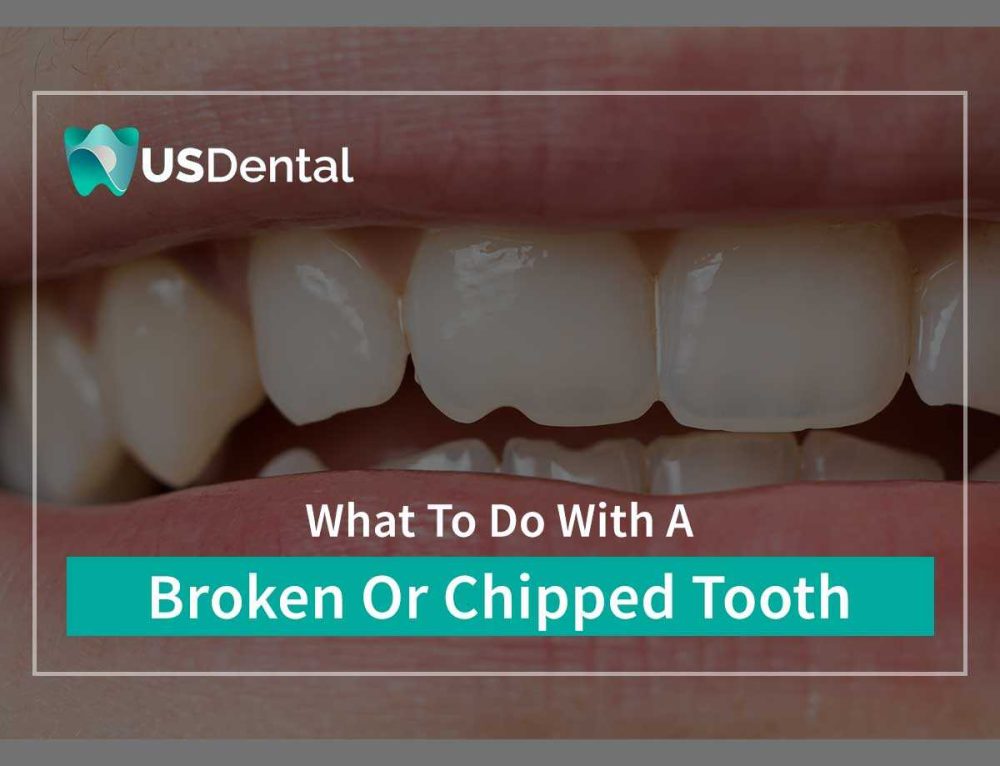 Healthy Oral Habits US Dental And Medical Care healthy-oral-habits-us-dental-and-medical-care