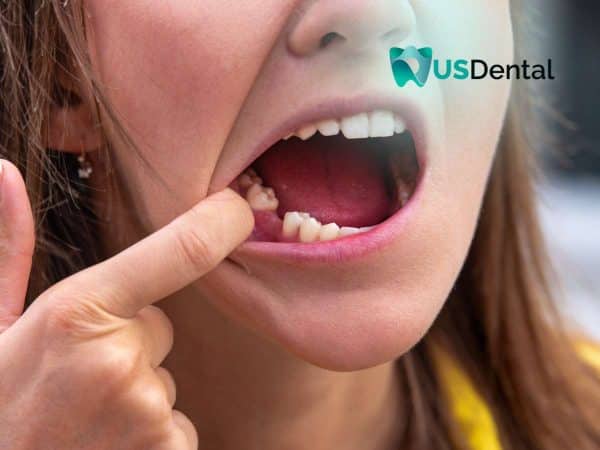 How Missing Teeth Can Affect Your Overall Health