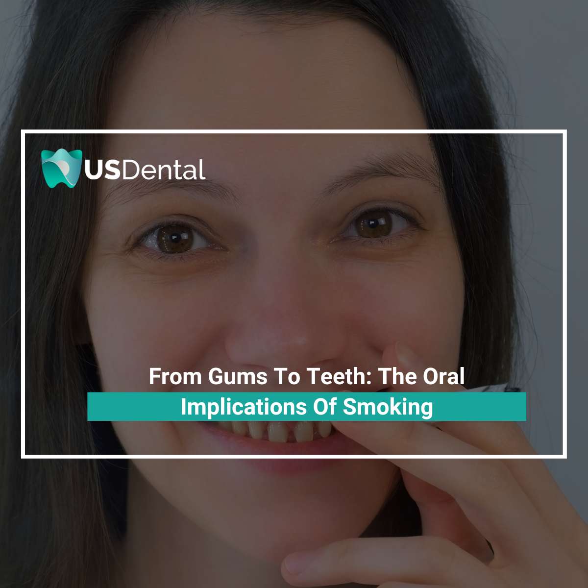 From Gums To Teeth: The Oral Implications Of Smoking