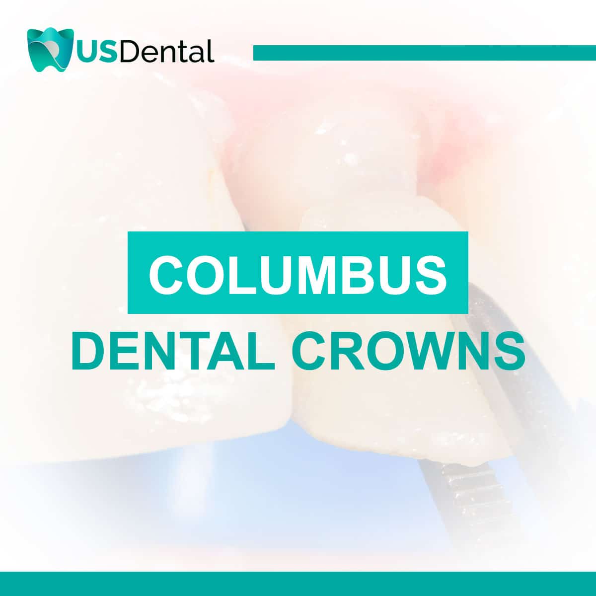Restore Your Smile with Custom Dental Crowns in Columbus, OH